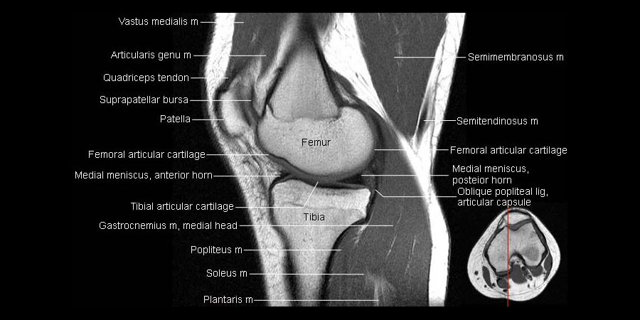 Anhvanyds - Tiếp cận MRI khớp gối (MRI of the knee)