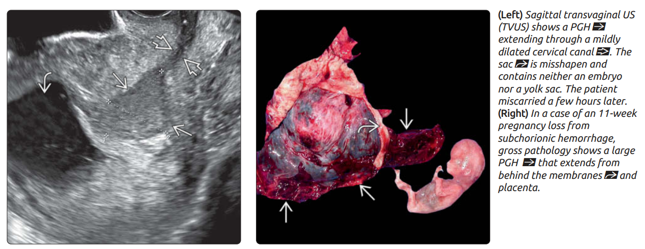 Screenshot 2025-02-04 122333