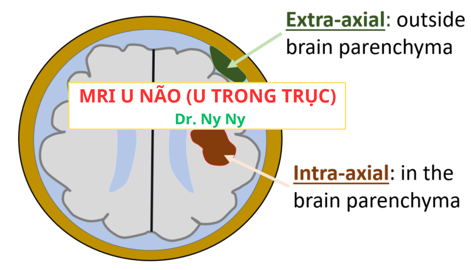 Anhvanyds - Tổn thương dạng tạo khối chủ yếu nằm trong trục (Primarily ...